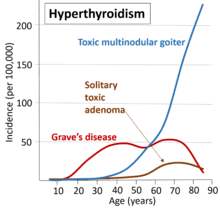 Hyperthyroidism immoderate manufacturing of thyroid hormone